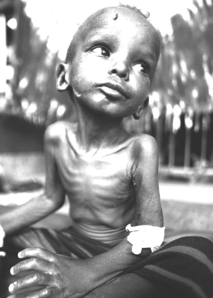 How Poverty, Poor Awareness Contribute to High Prevalence of Acute ...